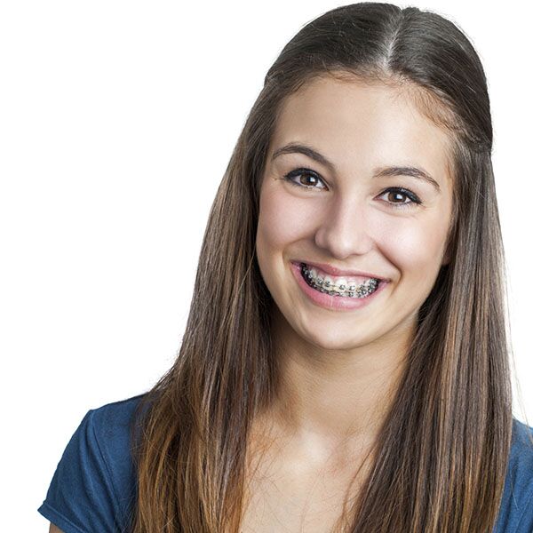 Braces | Seattle & Bellevue | Best Orthodontist